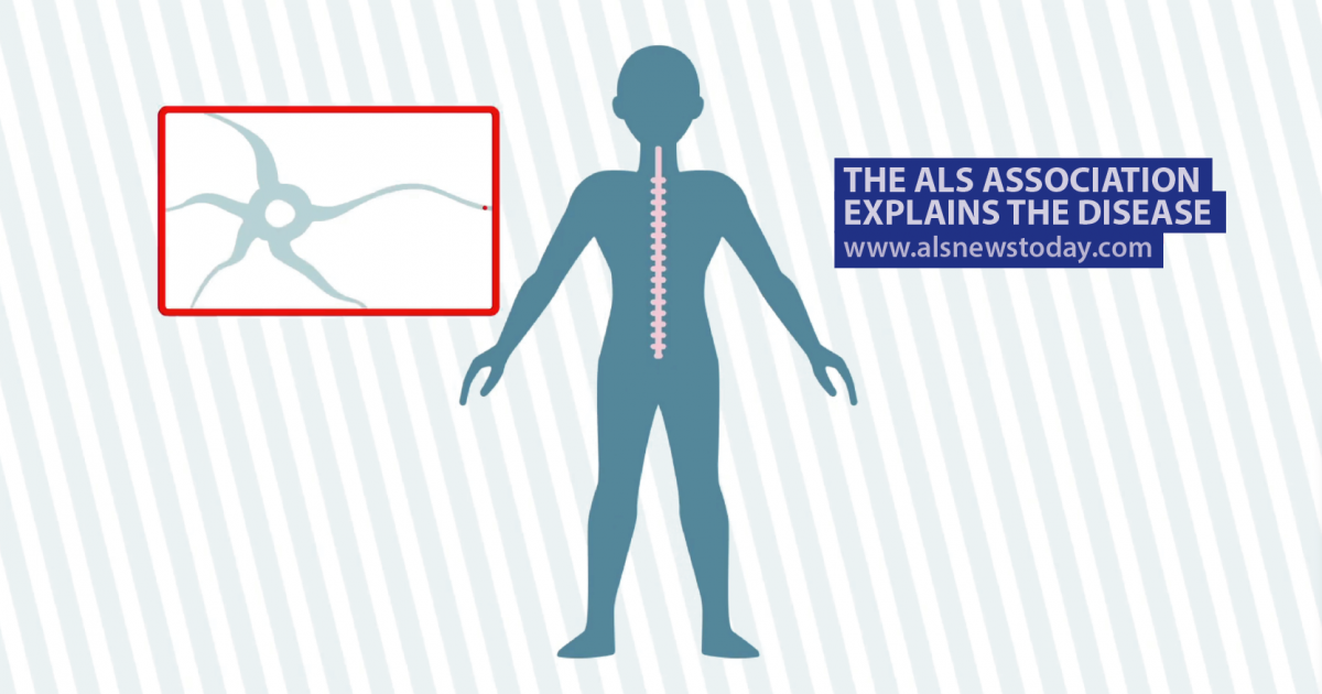The ALS Association Explains the Disease | ALS News Today