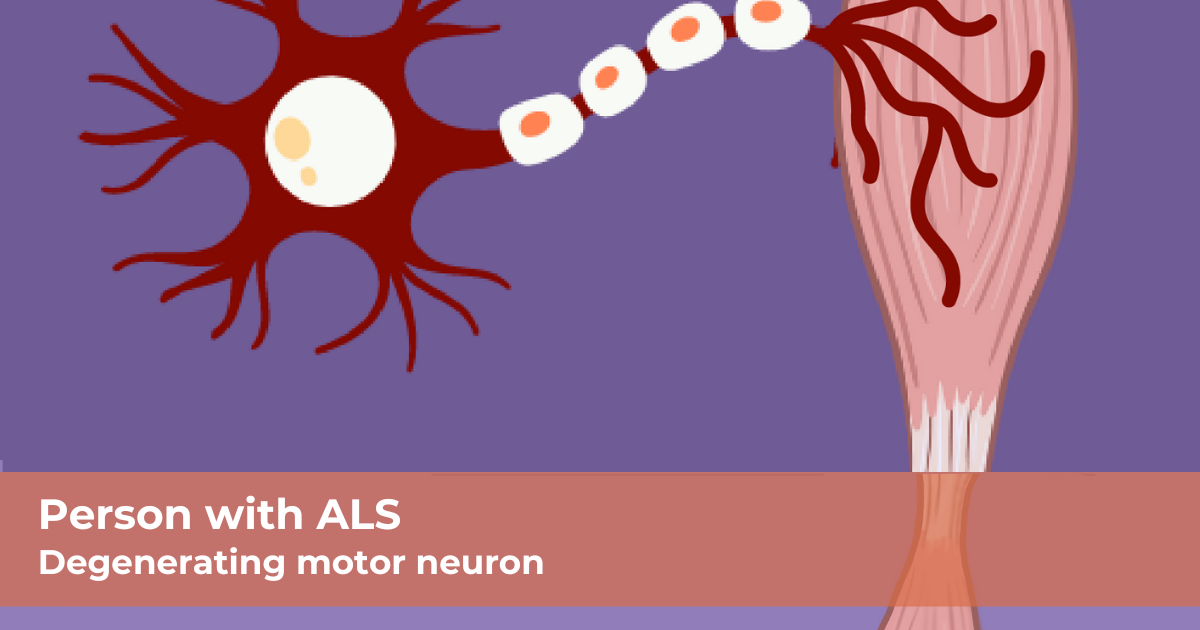What is Amyotrophic Lateral Sclerosis (ALS)? | ALS News Today What is Amyotrophic Lateral Sclerosis (ALS)? | ALS News Today